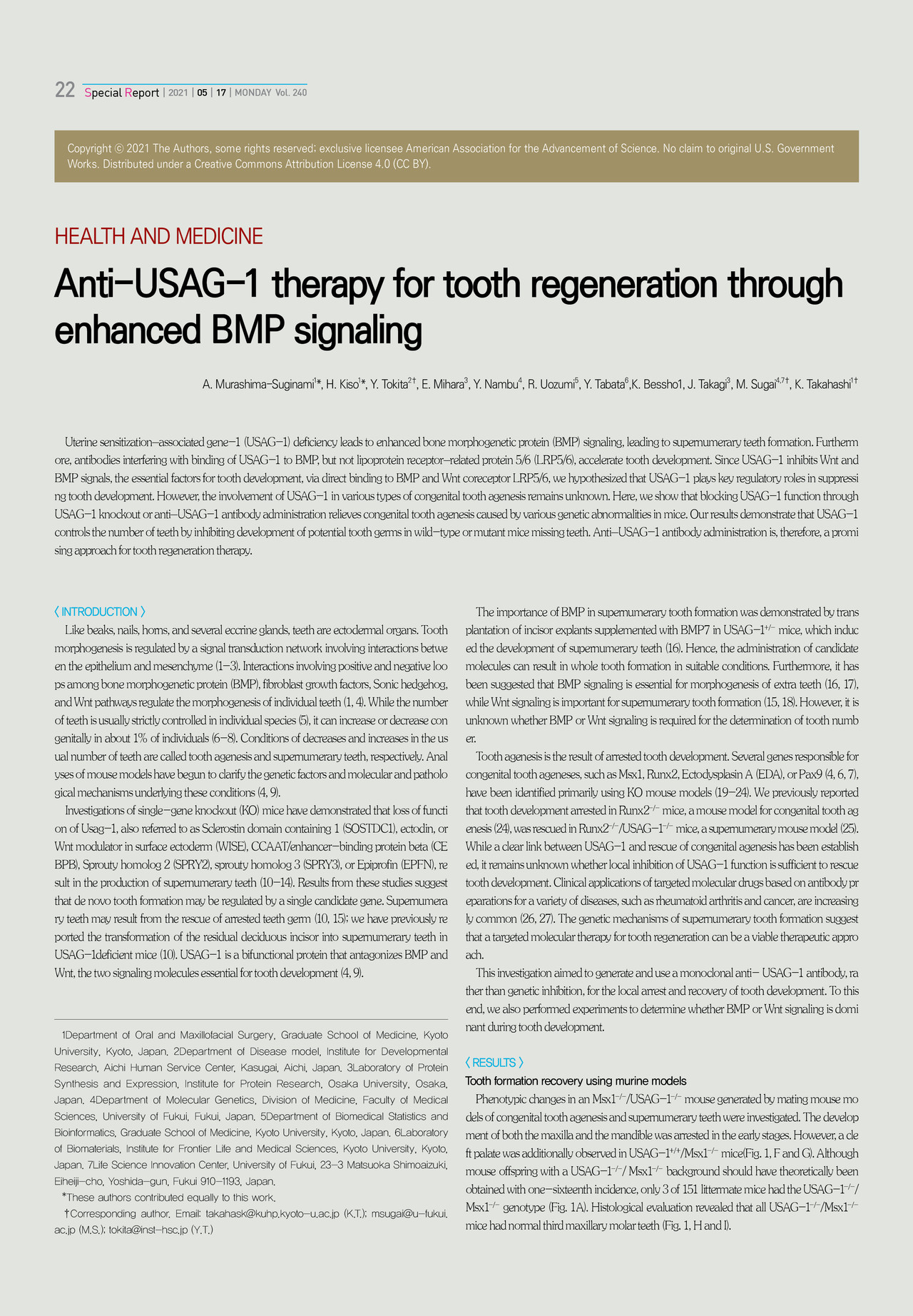 Anti-USAG-1 therapy for tooth regeneration through enhanced BMP signaling