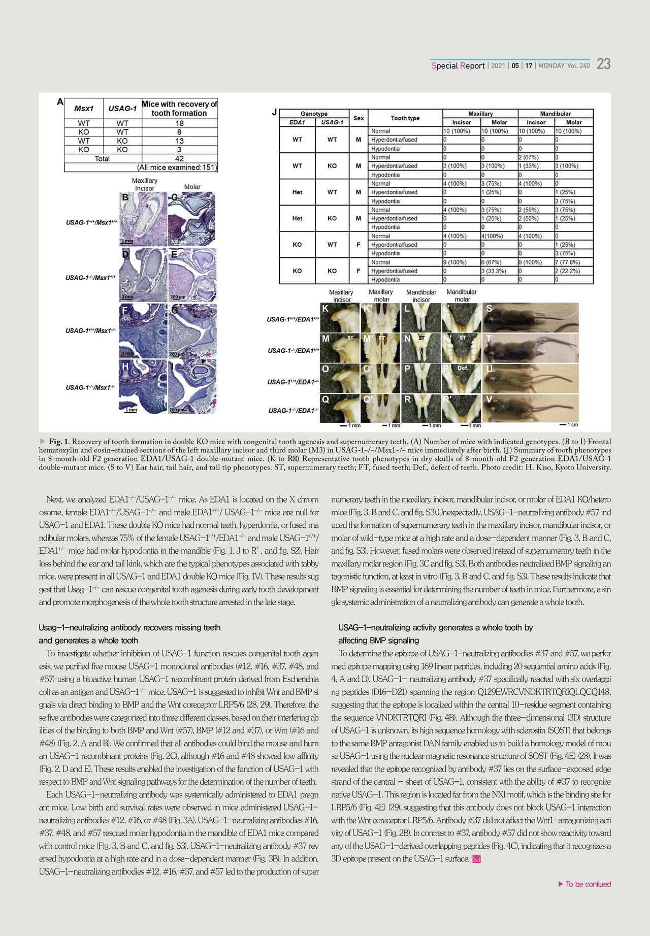 Anti-USAG-1 therapy for tooth regeneration through enhanced BMP signaling