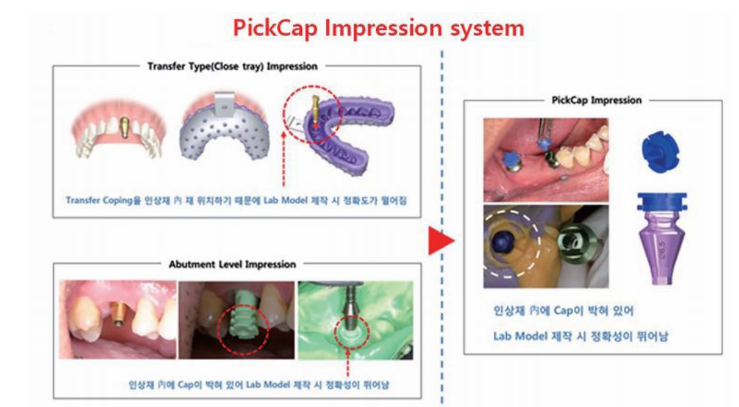 [신상완 명예교수] 임상특집